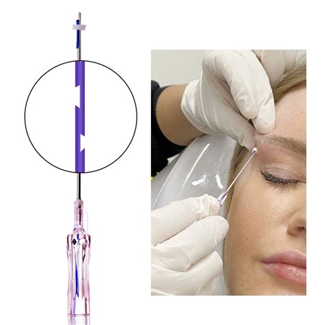 Korea Minerva Strongest Pulling Force Pdo Thread Korean Face Lifting