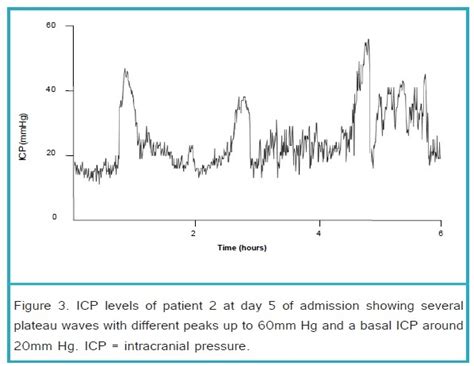 Plateau Waves Intracranial Hypertension Enliven Archive