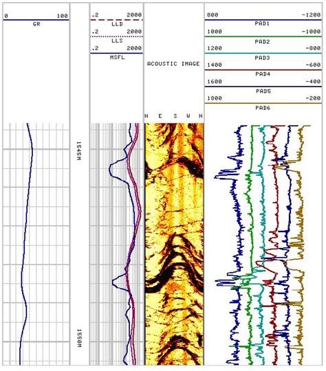 Fracture Identification