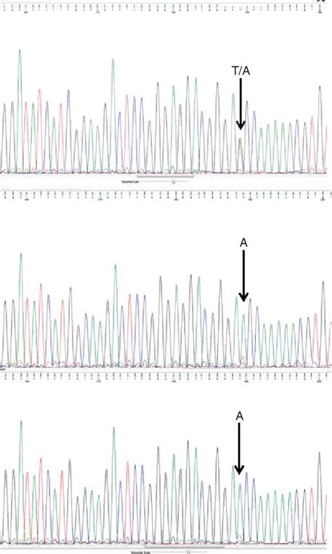 Sequence Analysis Of Part Of AIP Gene Exon Performed In Blood DNA Download Scientific Diagram