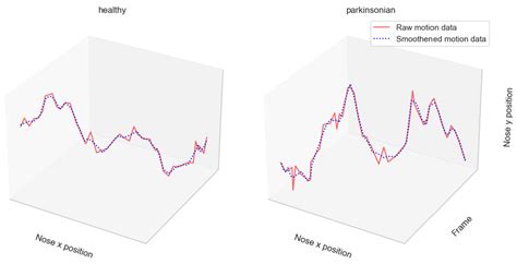 Pose Based Gait Analysis For Diagnosis Of Parkinsons Disease
