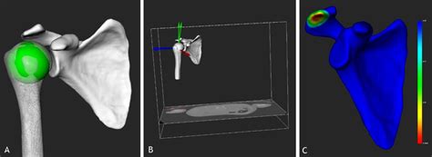 A Glenohumeral Center Computation B Bone Coordinates Systems Download Scientific Diagram