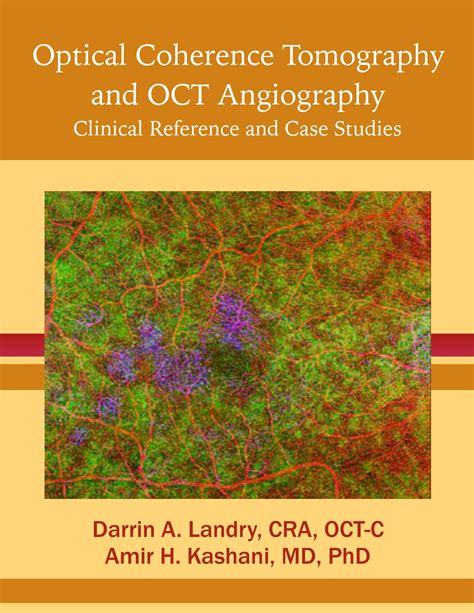 Optical Coherence Tomography And OCT Angiography PDF EPUB Version Downloadable Feetlux Store