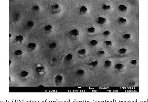 Figure 1 From Treatment Of Dentinal Hypersensitivity By Means Of Ndyap