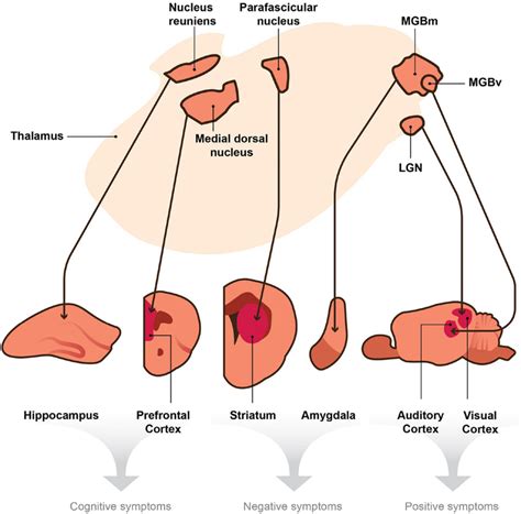 A Model Depicting The Hypothesis That The Thalamus Is A Central Node Download Scientific