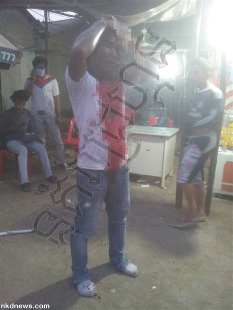 អ្នក ចាប់ ម៉ូយ ដាក់ រថយន្ត និង អ្នក រត់ រ៉ឺ ម៉ក ម៉ូតូ កង់ ៣ ផ្ទុះ ហិង្សា របួសធ្ងន់ ម្នាក់ នៅ