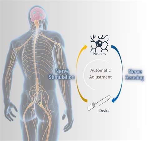 Inopase Wireless Powered Closed Loop Neuromodulation