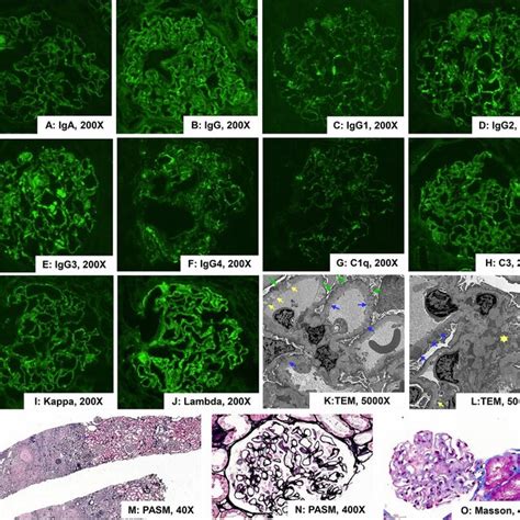 Lymph Nodes Histological Analysis By He And Ihc Staining A He Download Scientific Diagram