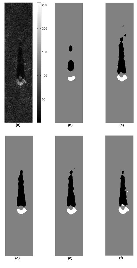 A Is The Original Image B ICM With A Median Filtering C ICM Download Scientific