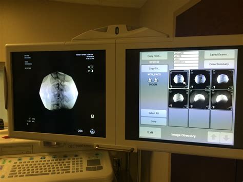 Peripheral Nerve Blocks Imaging Screen Richard W Hayes My Journey With God