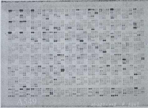The Result Graph Of A549 Cdna Macroarray Download Scientific Diagram