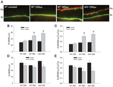 Effect Of Axial Tibial Loading On Periosteal And Endocortical Bone Download Scientific Diagram