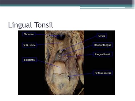 Histology Of Tonsil Pptx Ear Nose And Throat Conditions Diseases