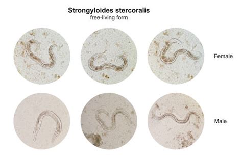 Strongyloides Stercoralis Larvae