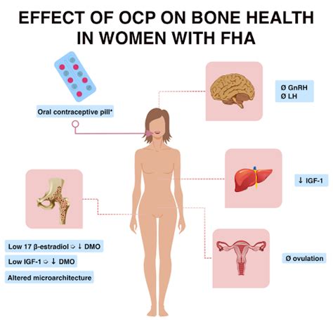 Breaking The Silence On Hypothalamic Amenorrhea And Oral Contraceptive