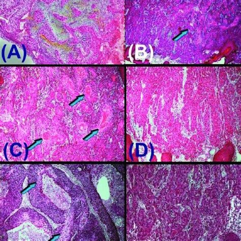 Composite Iconographic Plate Showing Tissue Transfiguration Of Download Scientific Diagram