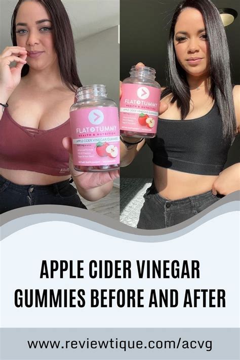 Apple Cider Vinegar Gummies Before And After Best Apple Cider Vinegar