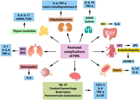 Systemic Inflammatory Response Syndrome Thromboinflammation And