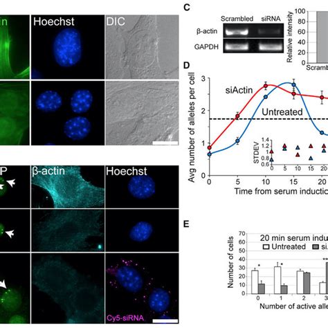 Dynamics Of β Actin Gene Activation Following Serum Induction