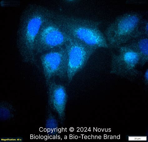 Calreticulin Antibody Bsa Free Nb600 101 By Novus Part Of Bio Techne
