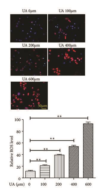 Role Of Nox4 Ros In Uric Acid Induced Emt In Nrk 52e Cells A Ros