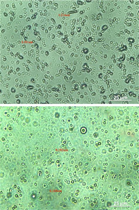 Optical Micrographs Of Control Niosomes Upper Figure And Niosomal Download Scientific Diagram