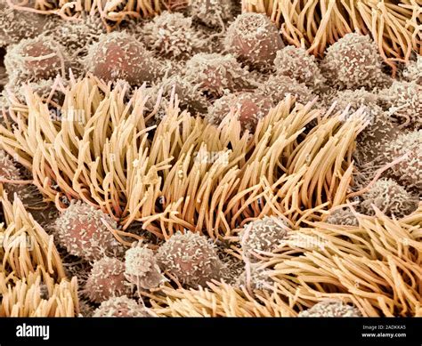 Fallopian Tube Coloured Scanning Electron Micrograph SEM Of The