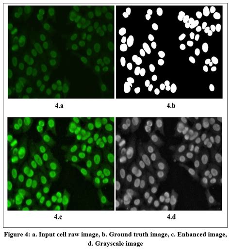 Human Epithelial Cell Image Analysis And Segmentation Using Threshold Based Fusion Technique