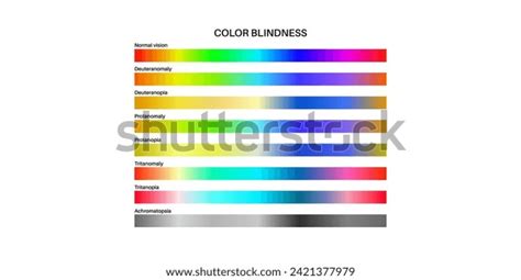 552 Colour Vision Defect Royalty Free Photos And Stock Images