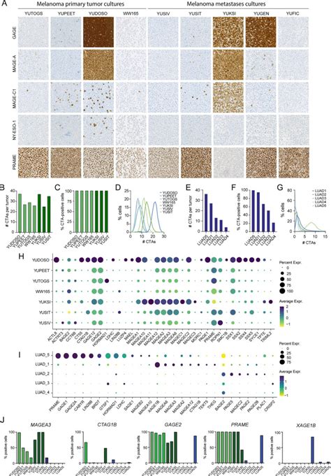 Single Cell Sequencing Unveils Extensive Intratumoral Heterogeneity Of