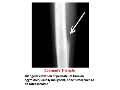 Drlaith Notes About Common Radiological Signs Drlaith Notes About Common Radiological Signs