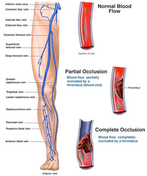 Peroneal Vein