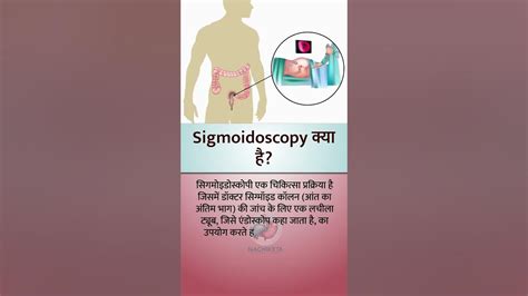 Sigmoidoscopy क्या है What Is Sigmoidoscopy Best Gastroenterology
