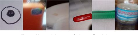 Figure 1 From Ensemble Deep Learning For Cervix Image Selection Toward