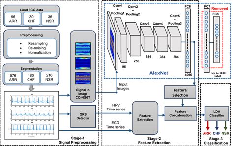 The Architecture Of The Proposed Ecg Multi Class Diagnosis System