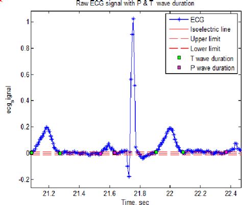 Figure 2 From Ecg Feature Extraction In Temporal Domain And Detection