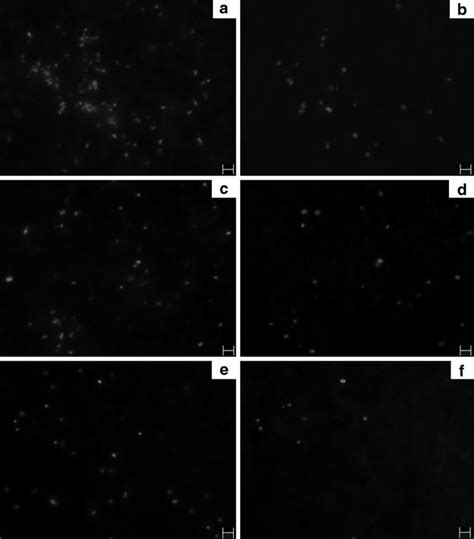 Digital Micrographs Of The Total Microbial Population Dapi Staining