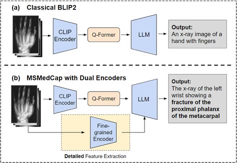 [2311 01004] sam guided enhanced fine grained encoding with mixed