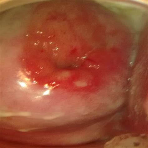 Cervical Cancer Instance Segmentation Model By Rnd Team