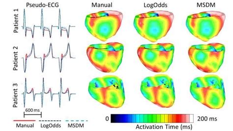 Comparison Of Pseudo Ecgs And Activation Maps From One Beat Of Sinus Download Scientific