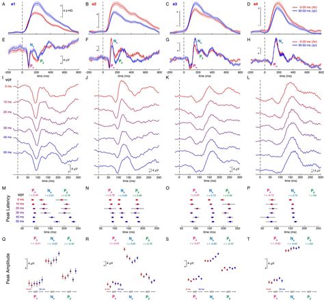 Figures And Data In Transformation Of A Temporal Speech Cue To A Spatial Neural Code In Human