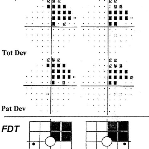 A 53 Year Old Woman With A Temporal Lobectomy For Epilepsy Control Had Download Scientific