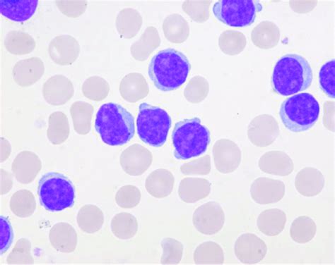 Small Cells Containing Distinct Nucleoli Basophilic Cytoplasm And Download Scientific Diagram