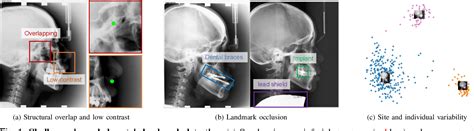 Figure 1 From Deep Learning Techniques For Automatic Lateral X Ray Cephalometric Landmark