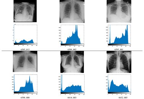 Chest X Ray Images Employed For The Segmentation Task With Their Download Scientific Diagram