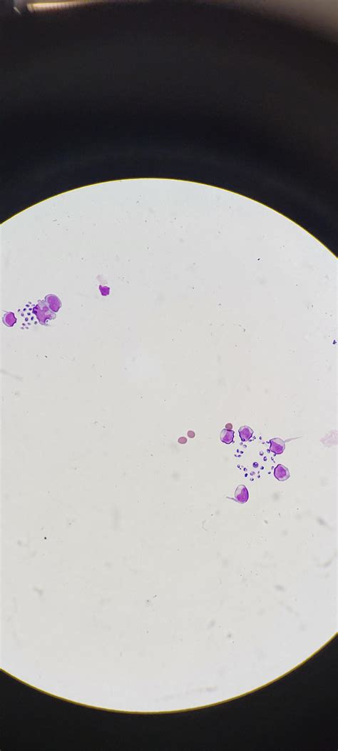 Sample Is Csf R Medlabprofessionals