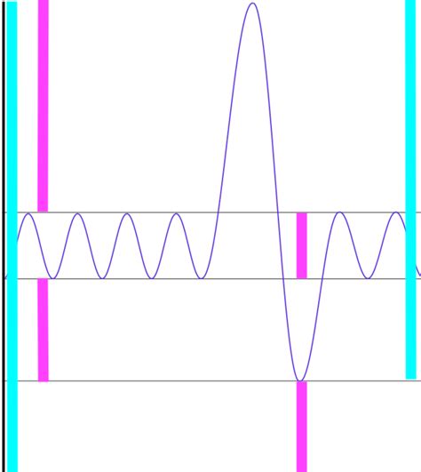 Diagram Of Lung Capacity Graph Quizlet