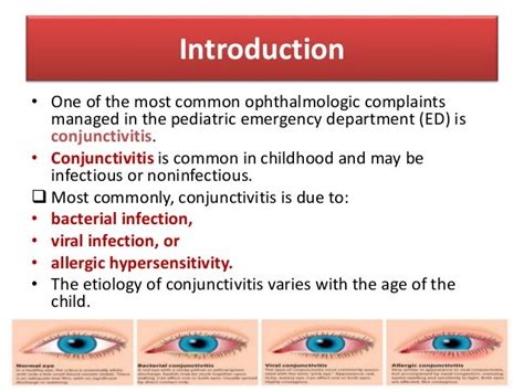 Diagnosis And Management Of Pediatric Conjunctivitis