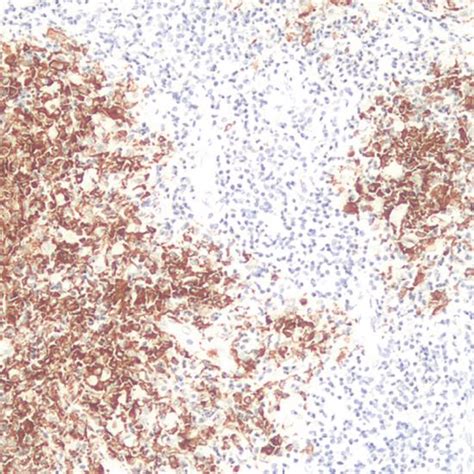 Langerin供应商 生产厂家 厦门通灵生物医药科技股份有限公司