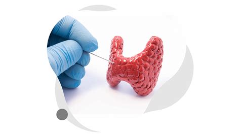 نمونه برداری غده تیروئید و 2 روش انجام آنآیا شما هم به